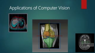 Computer vision ppt | PPTX