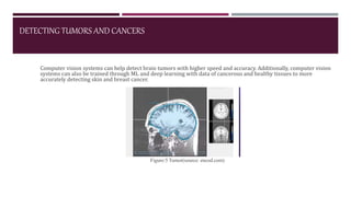 Computer Vision in Health Care (1).pptx