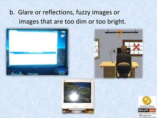 Computer vision syndrome | PPT