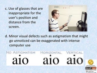 Computer vision syndrome | PPT
