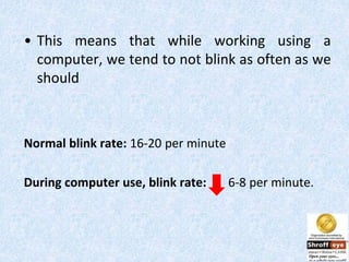 Computer vision syndrome | PPSX
