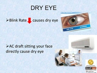 Computer vision syndrome | PPSX