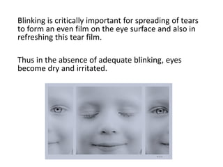 Computer vision syndrome | PDF