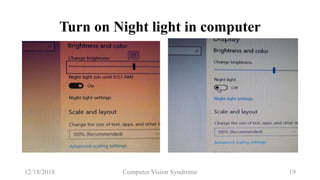 Computer vision syndrome (Digital eyestrain) | PPTX