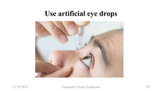 Computer vision syndrome (Digital eyestrain) | PPTX