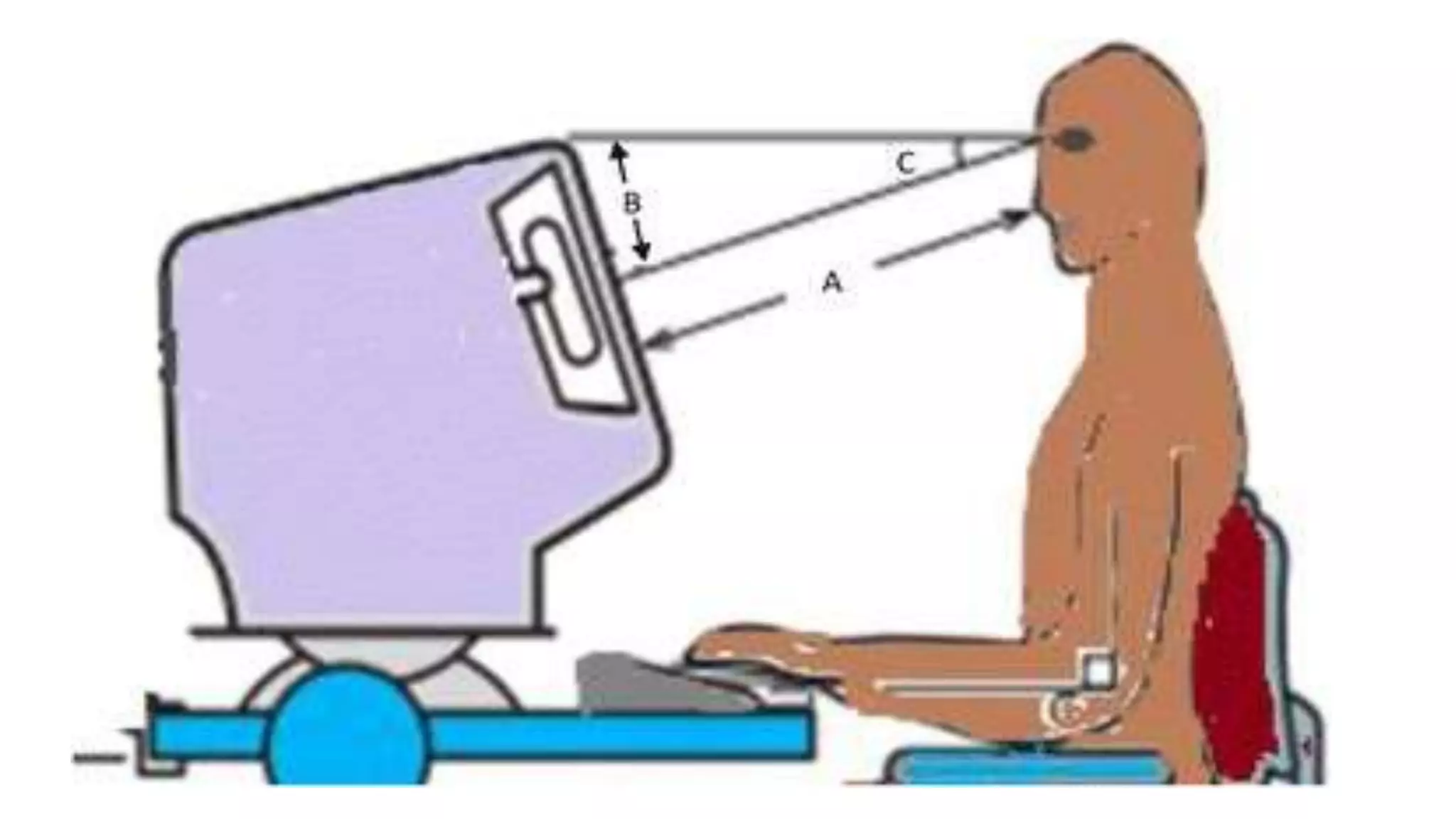 Computer vision syndrome | PPT