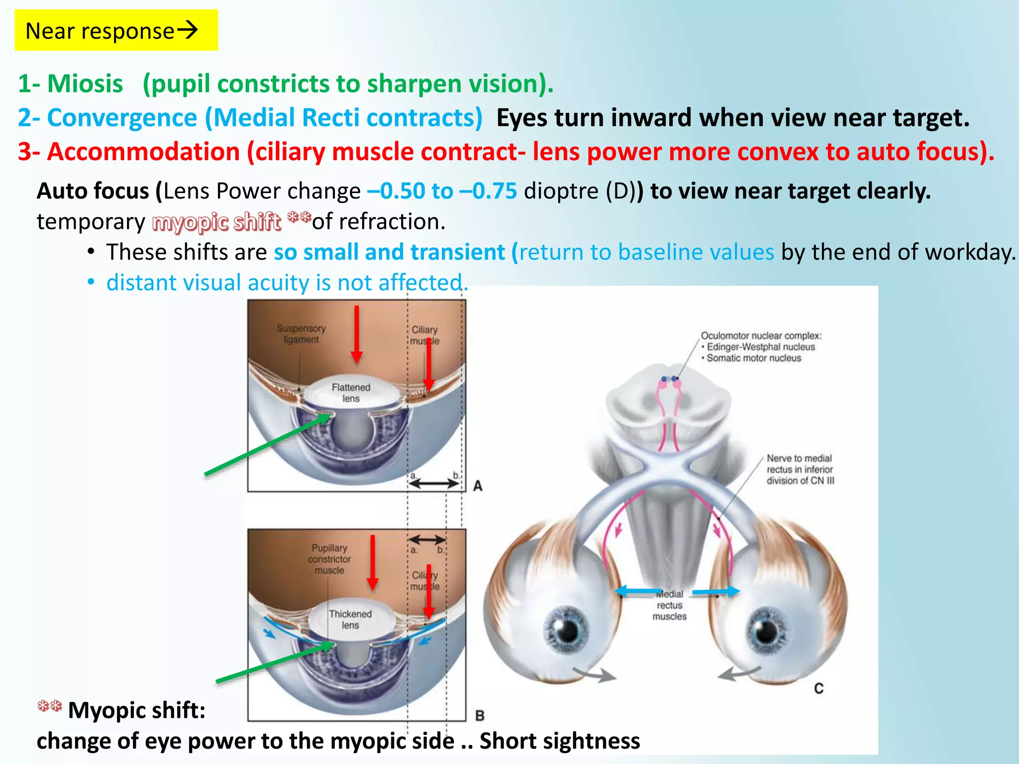 Computer vision syndrome by hala | PPT
