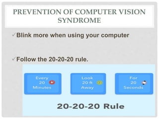 Computer vision syndrome document | PPTX