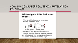 Computer vision syndrome by Dr. Gboneme Sandra | PPTX