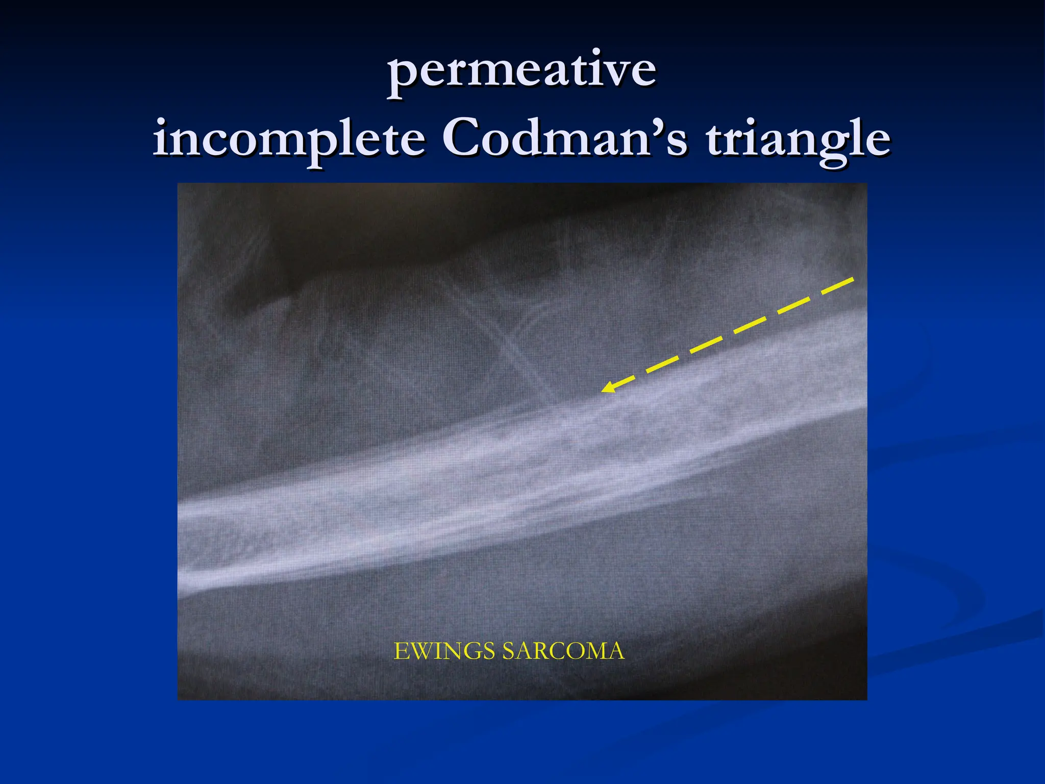 com, rad of bone tumors education textbook | PPT