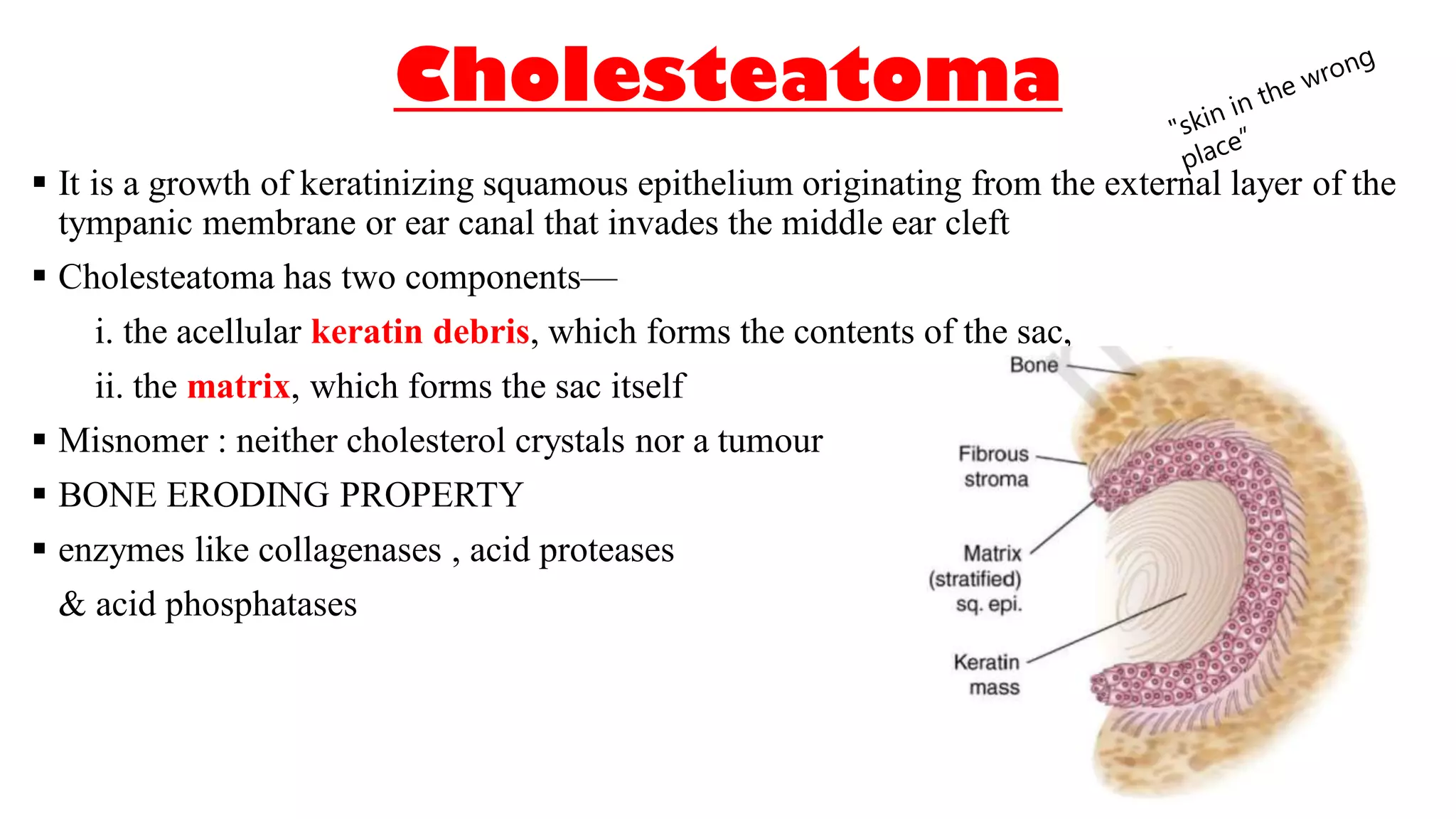 Chronic Otitis Media - Squamosal type ( UG) | PDF