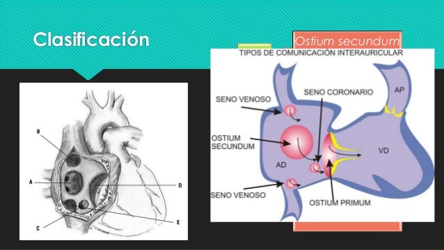 Comunicacin Interauricular Wikipedia La Enciclopedia Libre