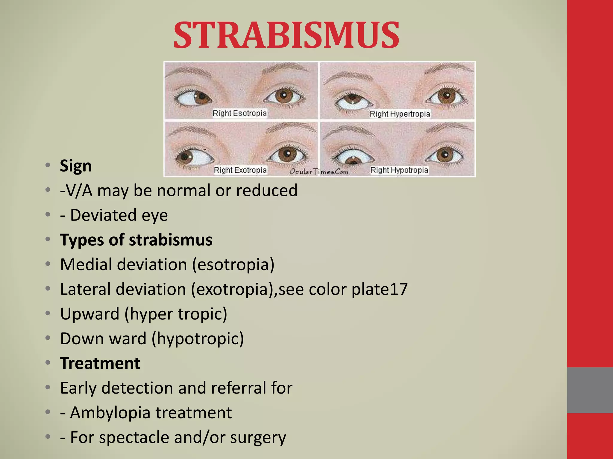 comunity ophthalmology - 2.pptx