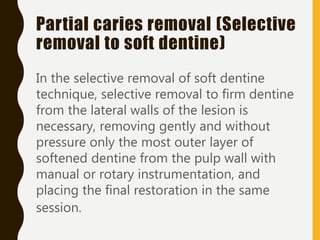 Conservative caries management | PPT