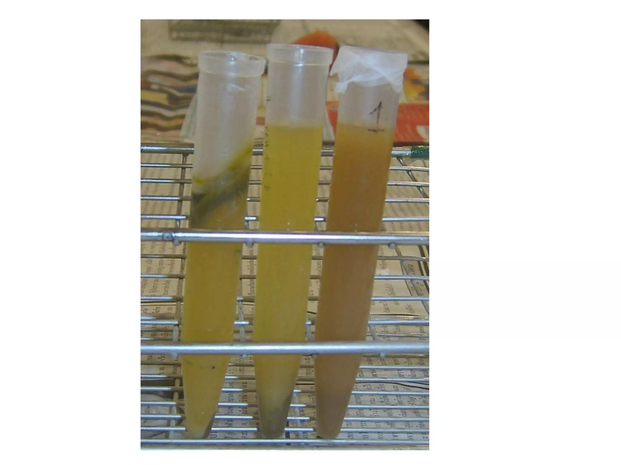 Concentration techniques for feacal examination | PPTX