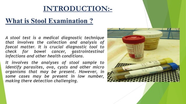 Concentration Techniques for stool examination .pptx | Digestive Disorders | Diseases and Conditions