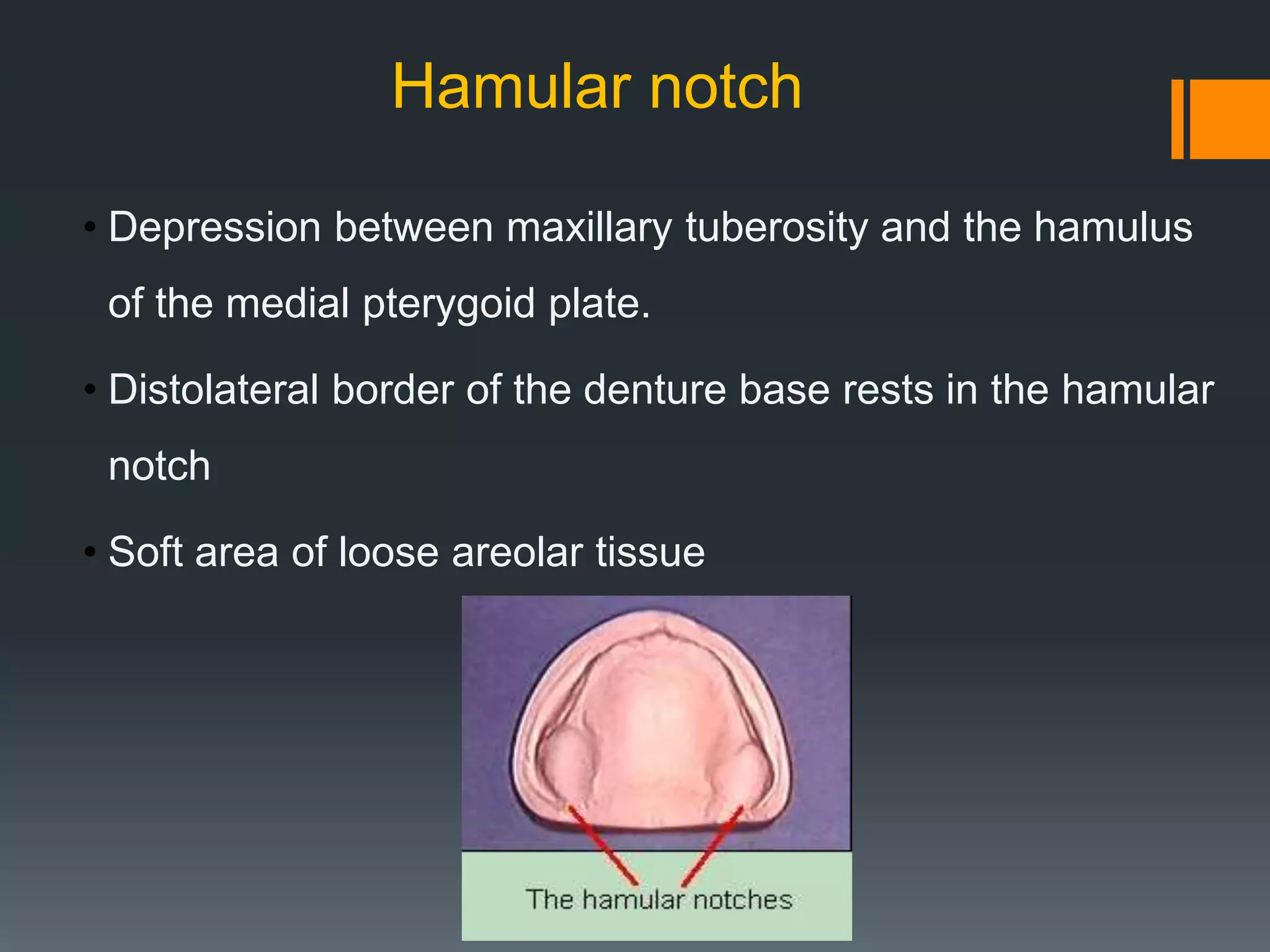 Concept and tecnique of impression making in complete dentures | PPTX