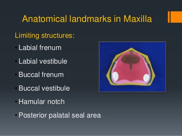 Concept and tecnique of impression making in complete dentures