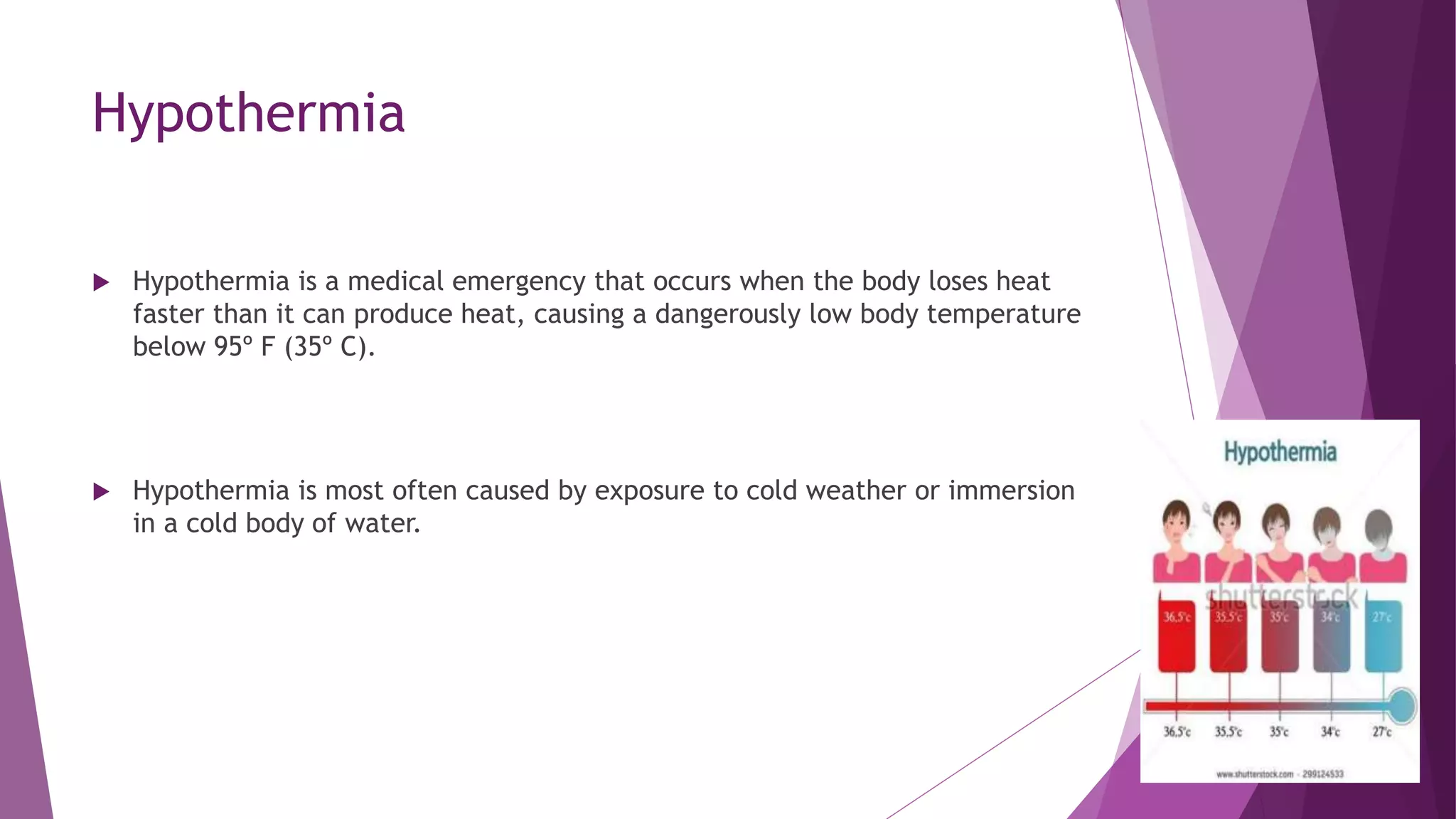 Concept of hyperpyrexia and hypothermia | PPTX