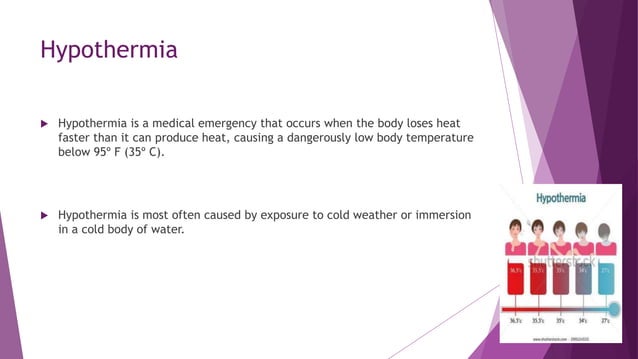 Concept of hyperpyrexia and hypothermia | PPTX | Weather | Science