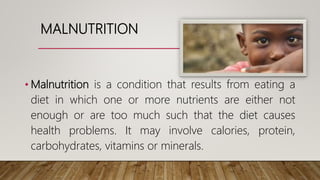 Concept of nutrition, Food, nutrition, malnutrition and balanced diet ...