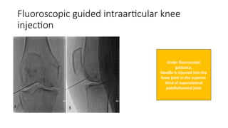 concept of pain medicine.pptx New emerging trends in pain medicine | PPTX