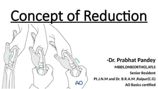 Concept of Fracture Reduction in orthopedics | PPTX