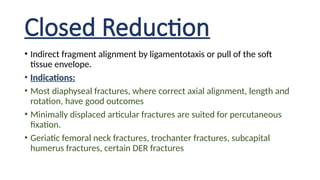 Concept of Fracture Reduction in orthopedics | PPTX