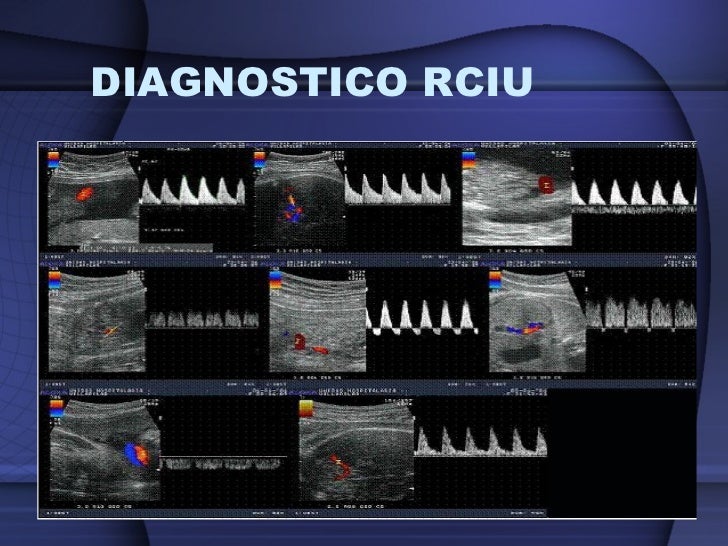 Conceptos basicos de Doppler fetal