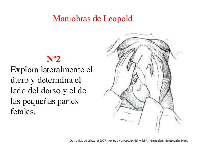 MANIOBRAS DE LEOPOLD OBSTETRICIA PDF