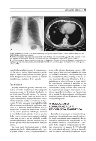 Conceptos básicos imagenología torax | PDF