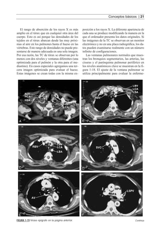Conceptos básicos imagenología torax | PDF