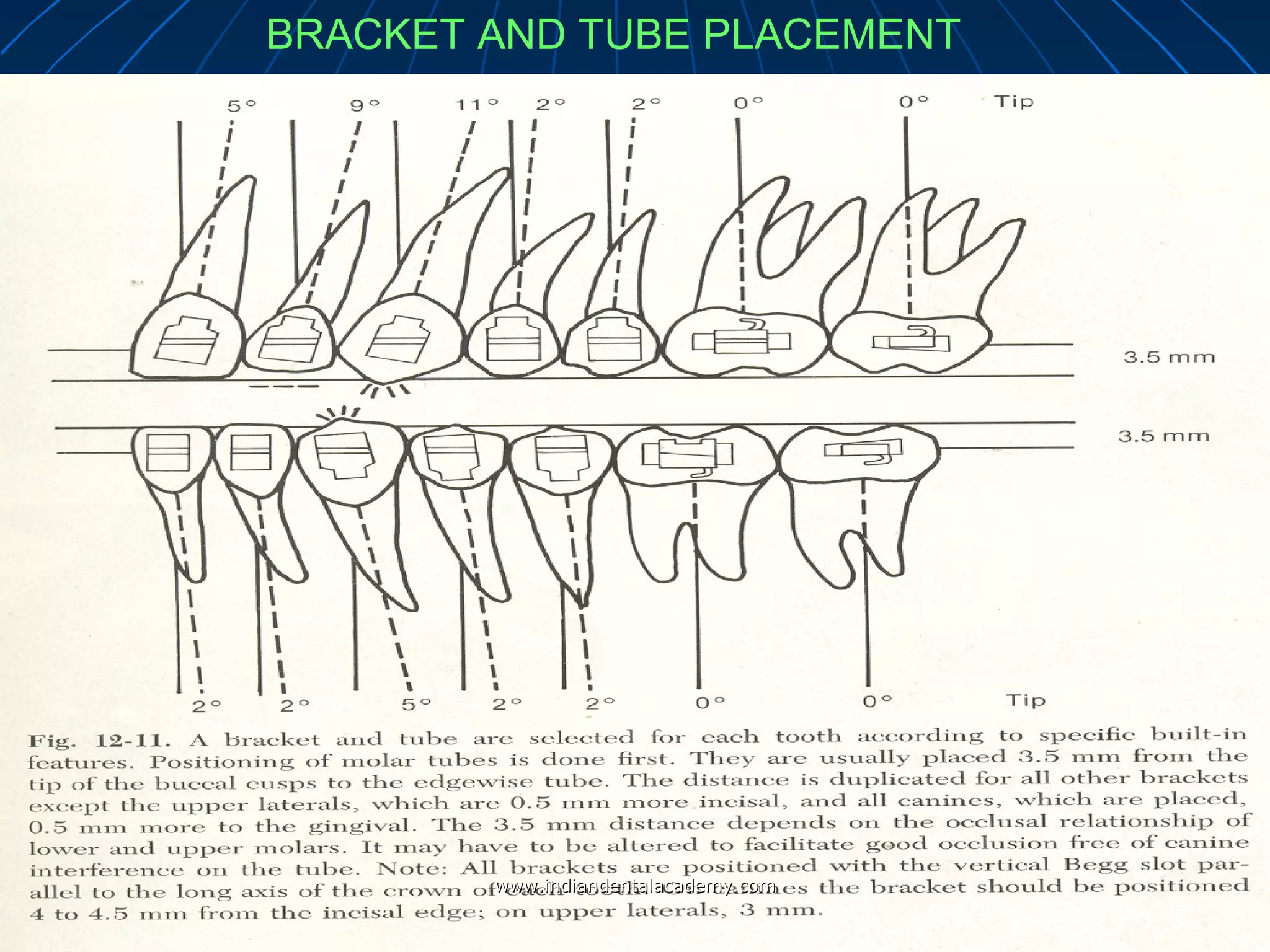 Concepts of orthodontic bracket positioning techniques / fixed ...