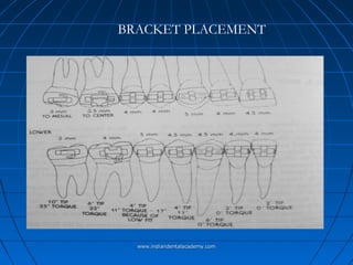 Concepts of orthodontic bracket positioning techniques / fixed ...