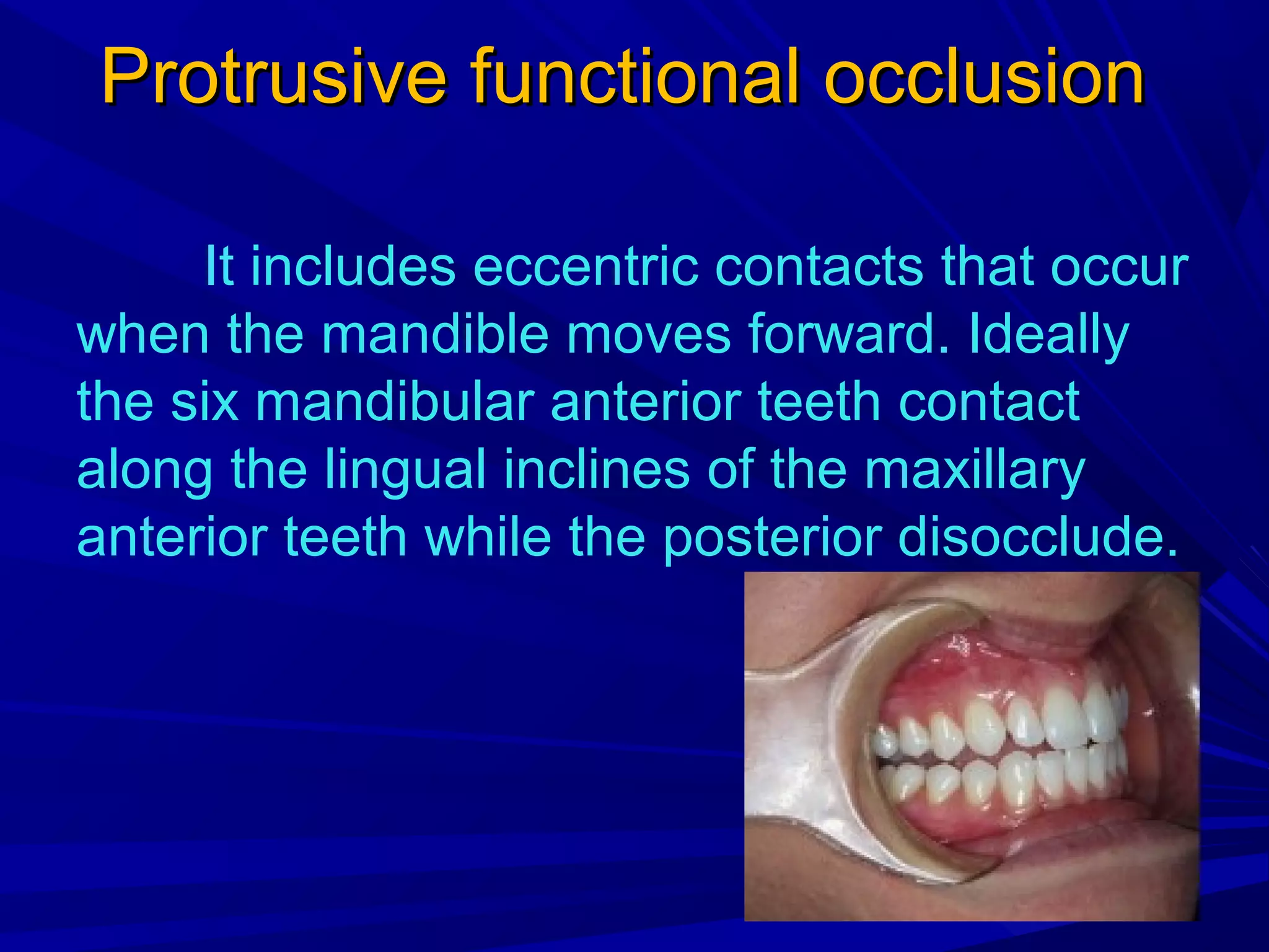 Concepts of dental occlusion and importance of six keys of occlusion in ...