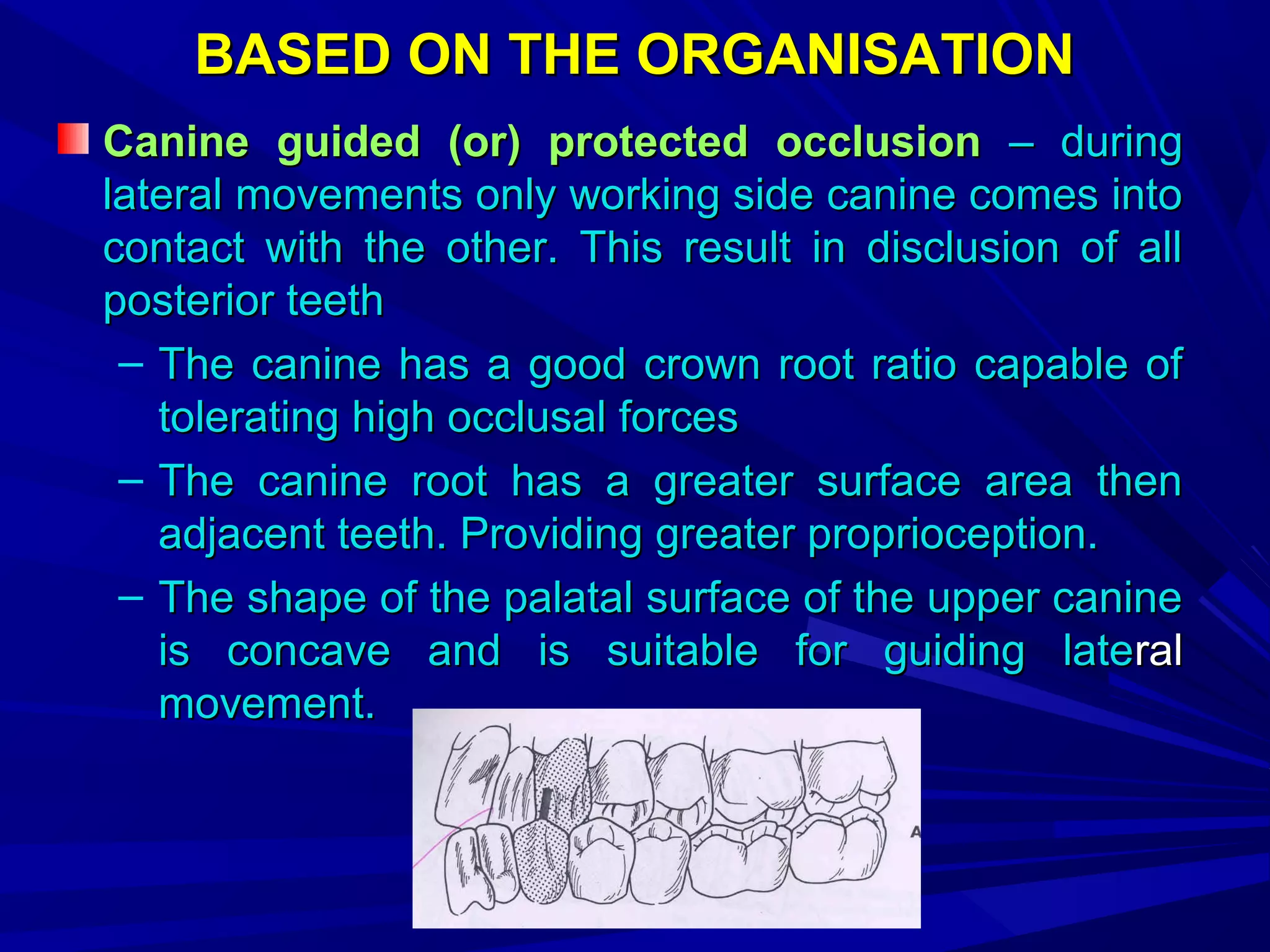 Concepts of dental occlusion and importance of six keys of occlusion in ...
