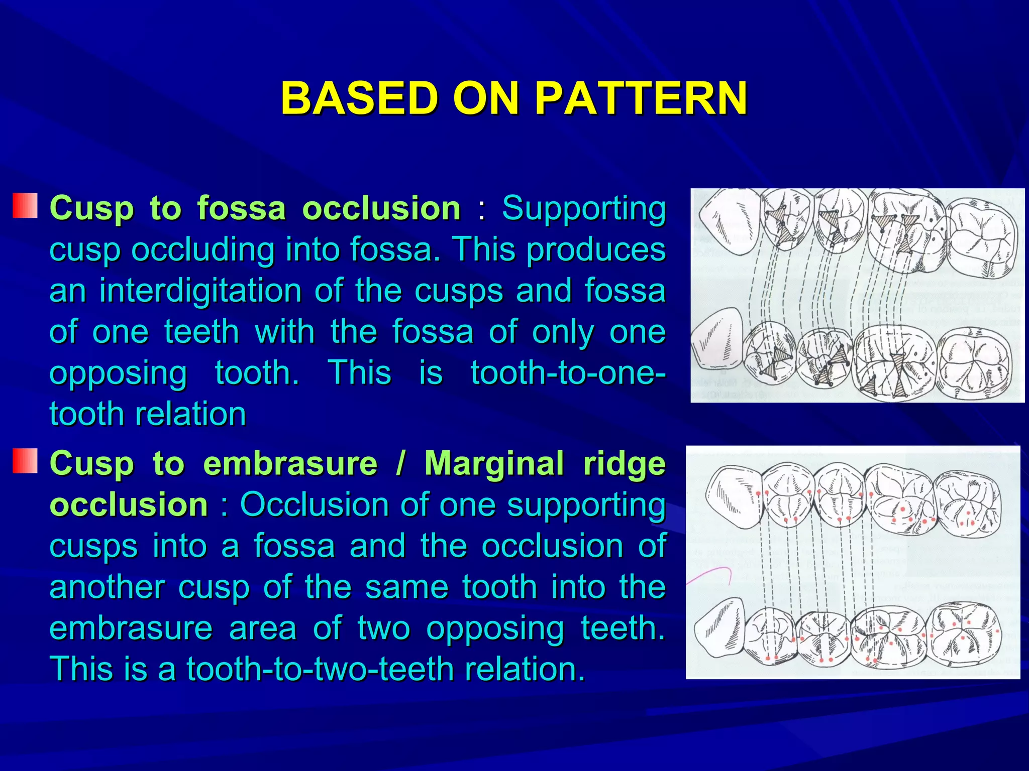 Concepts of dental occlusion and importance of six keys of occlusion in ...