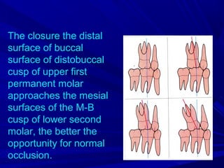 Concepts of dental occlusion and importance of six keys of occlusion in ...