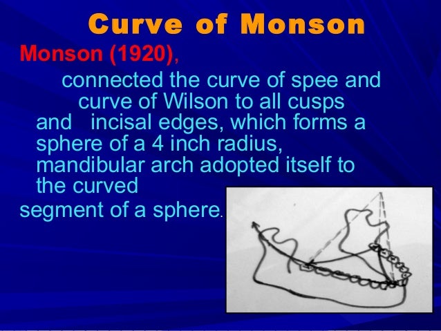 @齒顎矯正每日一說~~0156 curve of Monson(蒙森曲線)－崇愛牙醫診所(資料重建中,歡迎新舊朋友)｜痞客邦