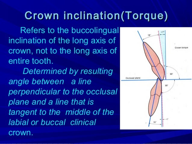 Concepts of dental occlusion and importance of six keys of occlusion…