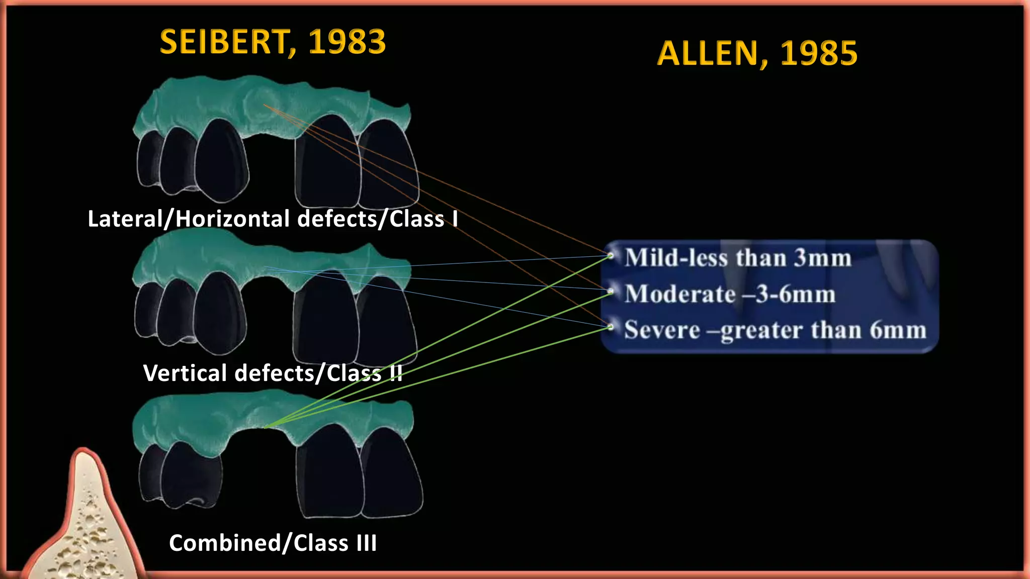 Concepts of ridge augmentation | PPTX