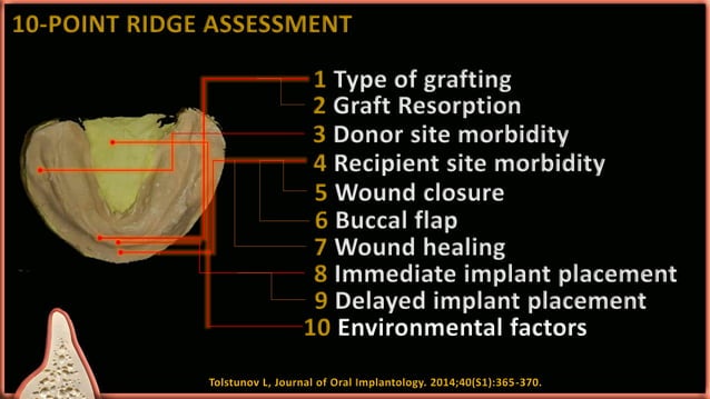 Concepts of ridge augmentation | PPTX