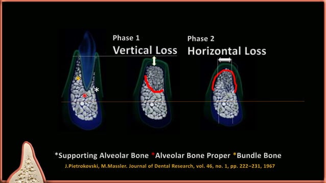 Concepts of ridge augmentation | PPTX