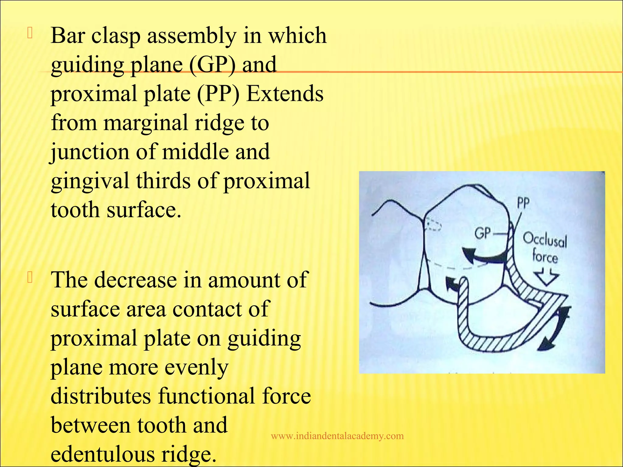 Concepts of rpi/ dentistry dental implants | PPT