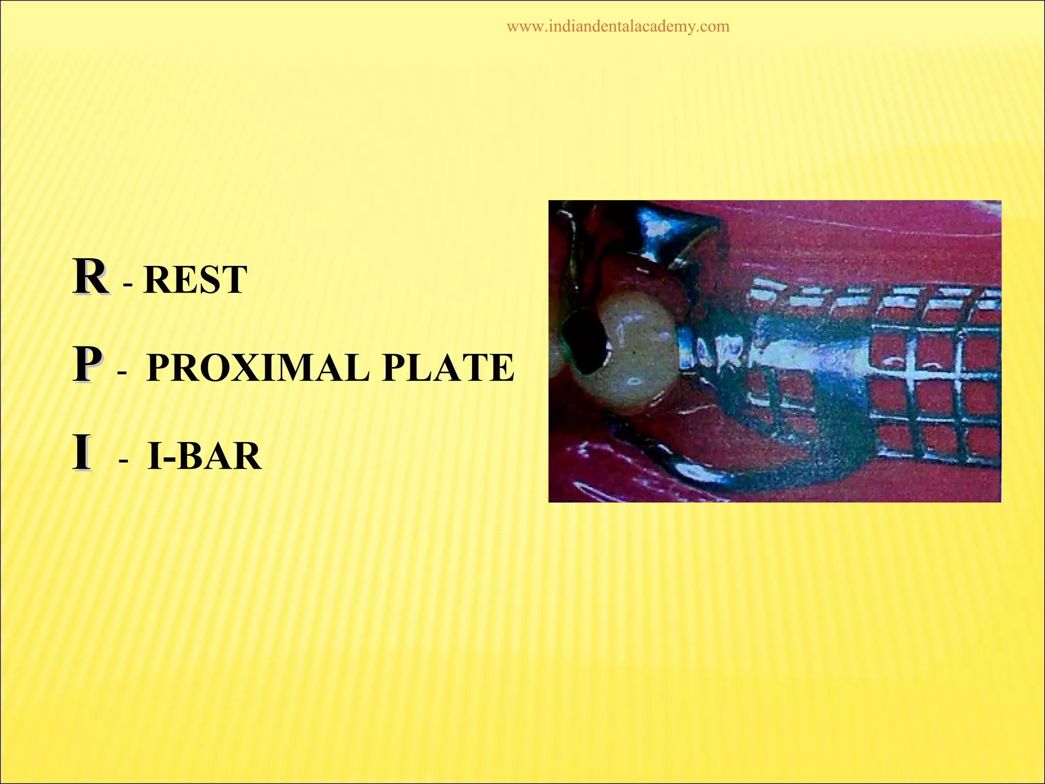 Concepts of rpi/ dentistry dental implants | PPT