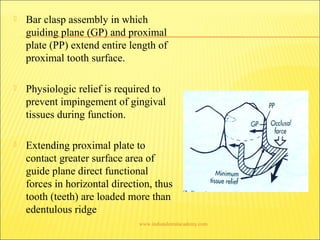 Concepts of rpi/ dentistry dental implants | PPT