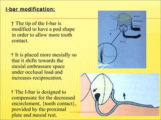 Concepts of rpi/ dentistry dental implants | PPT