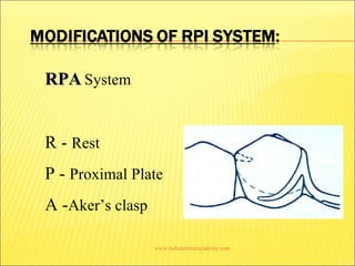 Concepts of rpi/ dentistry dental implants | PPT
