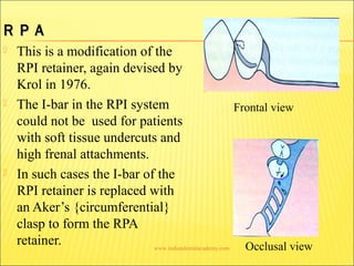 Concepts of rpi/ dentistry dental implants | PPT