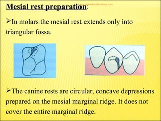 Concepts of rpi/ dentistry dental implants | PPT